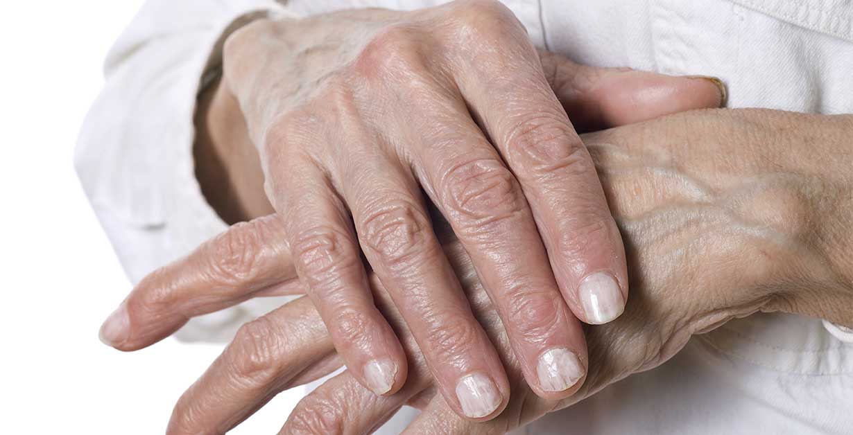 What is Gout? | Common Signs, Symptoms and Treatment Options